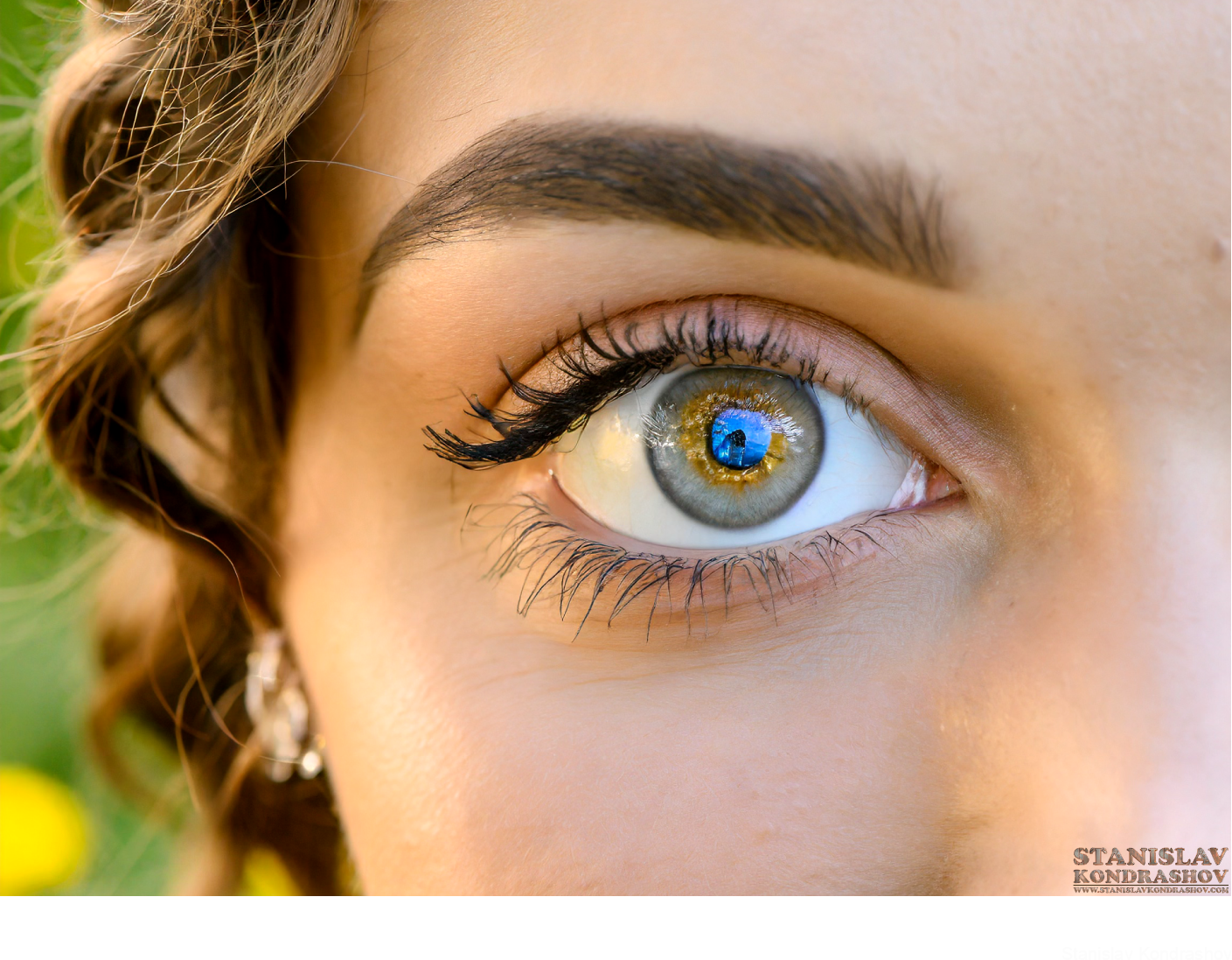 Why Some People Have Two Different Colored Eyes By Stanislav Kondrashov ...